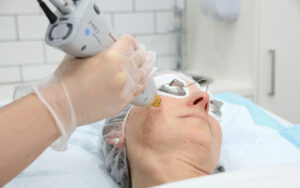Skin Treatments | Achieve Radiant Skin - Silk Laser