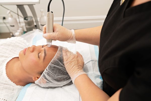 Microdermabrasion Skin Treatment - SILK Laser Clinics
