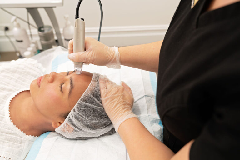 Microdermabrasion Skin Treatment - SILK Laser Clinics