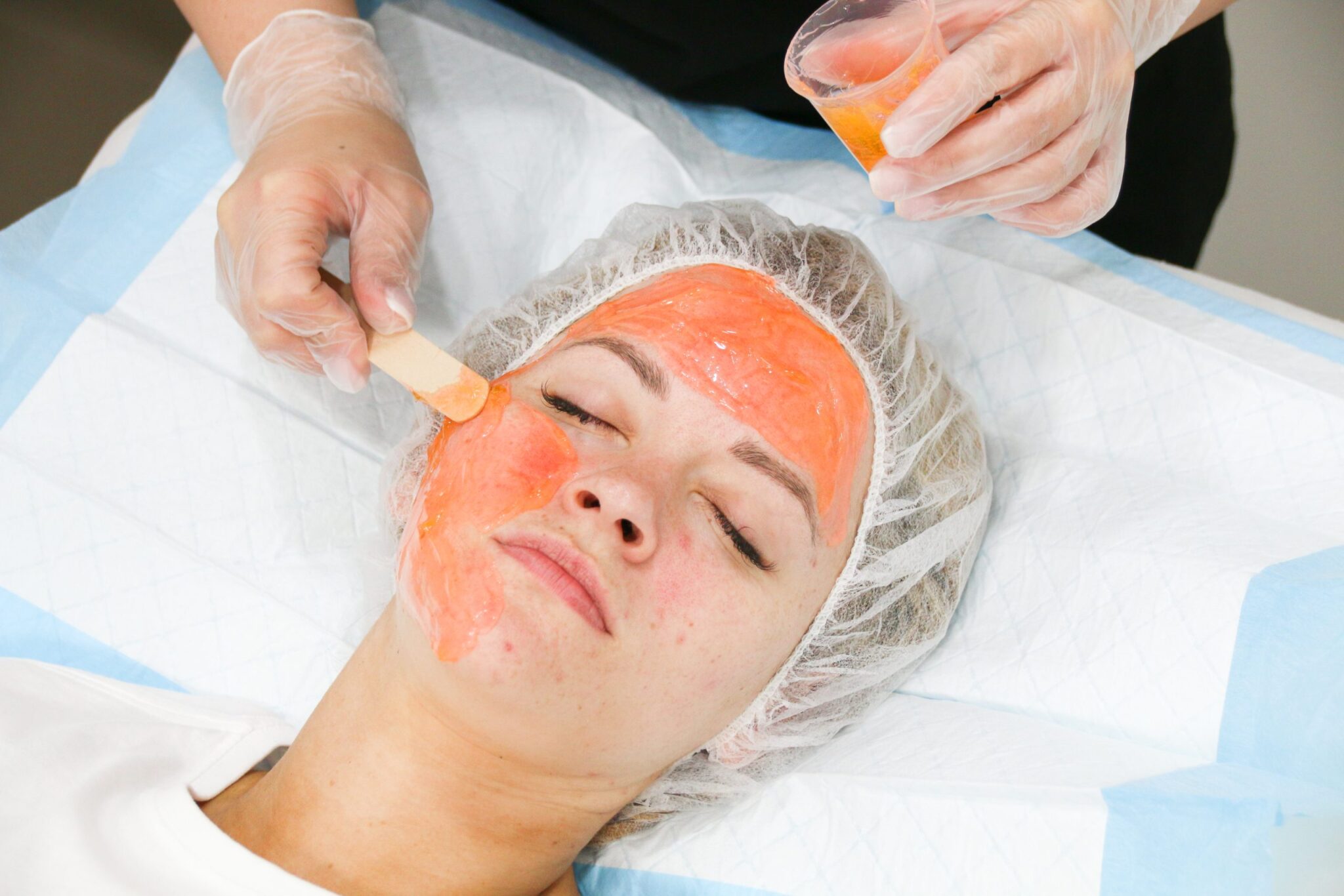 How does Lumixa work? - SILK Laser Clinics