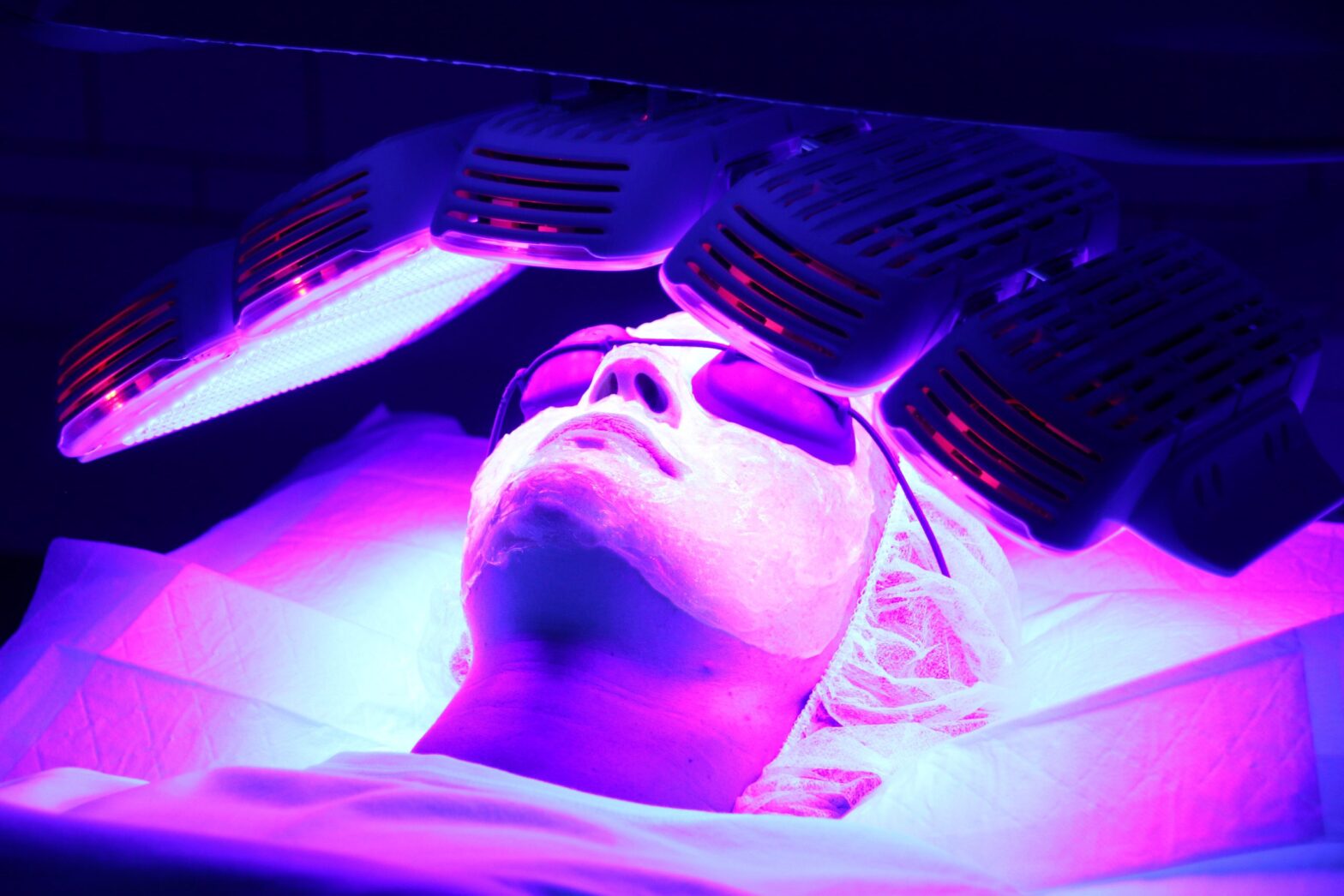 Skin Treatments | Achieve Radiant Skin - Silk Laser