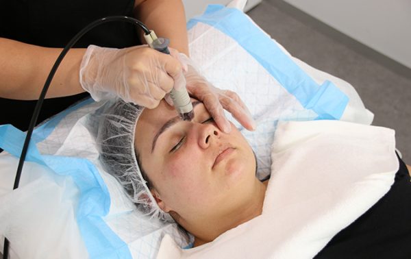 Medifacials - SILK Laser Clinics